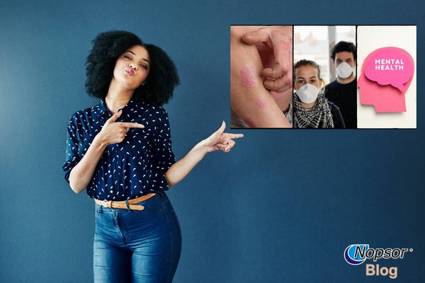 5 Things People with Psoriasis Wish Others Knew - Nopsor USA