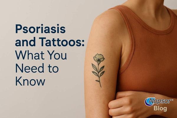 Psoriasis and Tattoos: Everything You Need to Know Before Getting Inke - Nopsor USA
