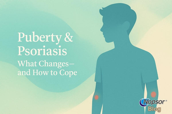 Puberty & Psoriasis: How Hormones Trigger Flares + Coping Tips - Nopsor USA