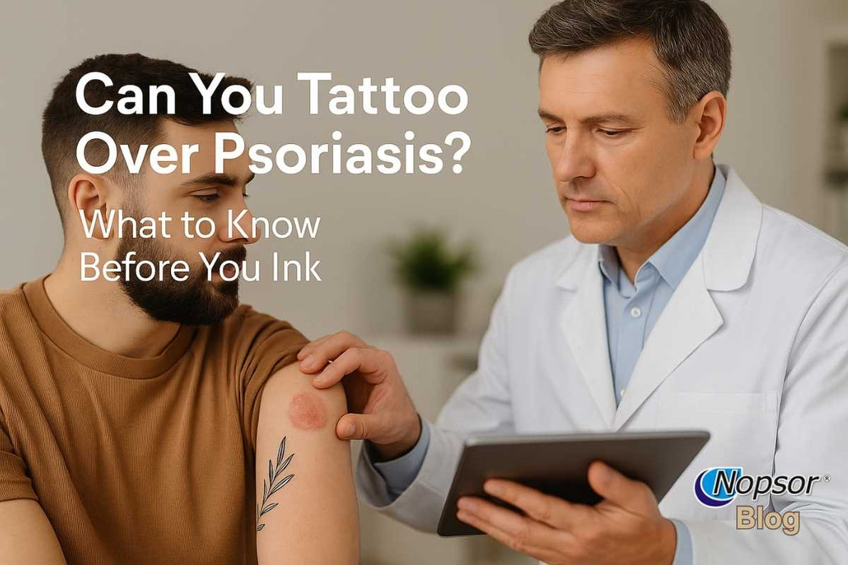 Can You Tattoo Over Psoriasis? What to Know Before You Ink - Nopsor USA