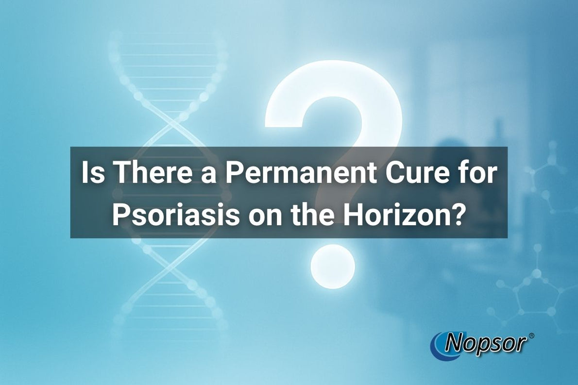 ¿Existe una cura permanente para la psoriasis en el horizonte? - Nopsor USA