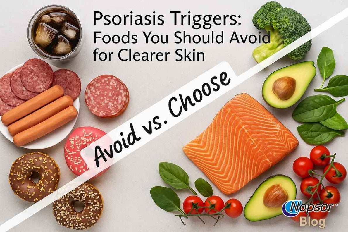 Psoriasis Triggers: Foods You Should Avoid for Clearer Skin - Nopsor USA